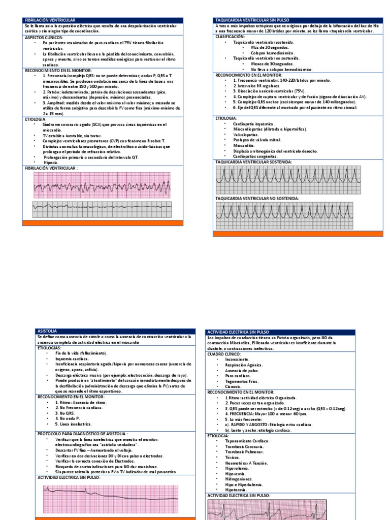 Tarjetas Taller Ekg Arritmias Letales | PDF | Electrocardiografia | Sistema cardiovascular