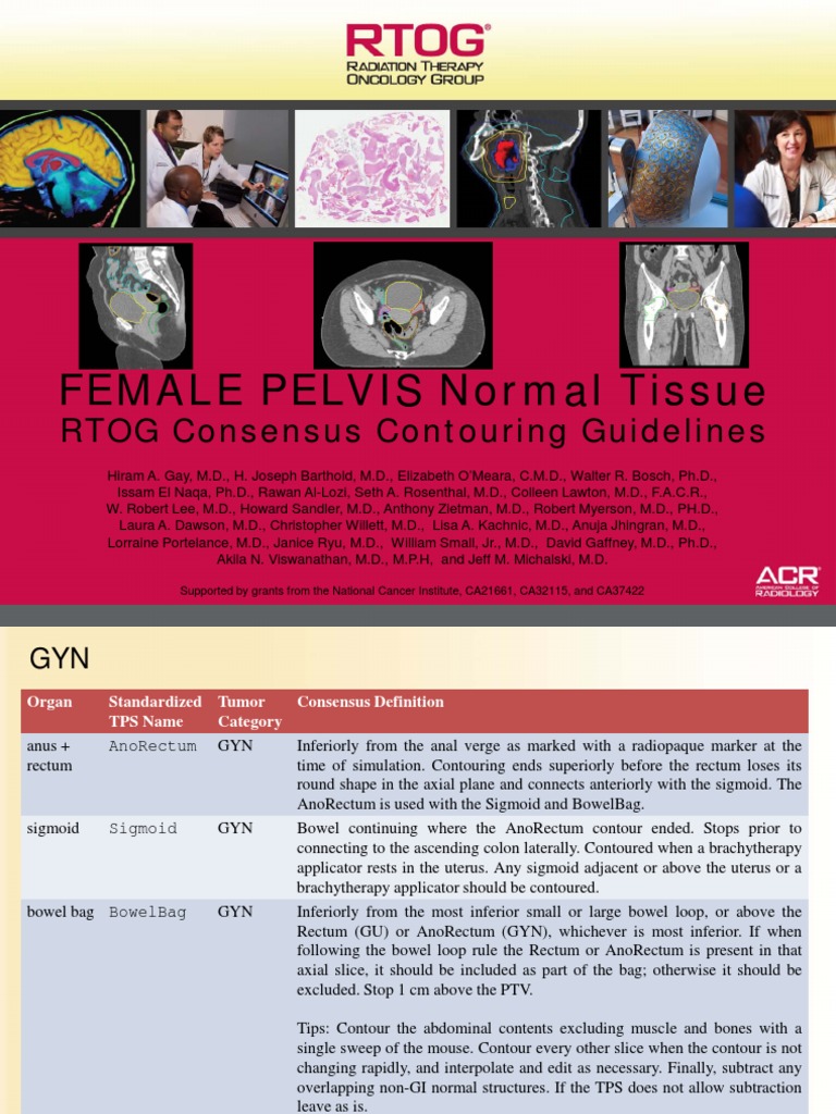 RTOG Contouring Guidelines for Female Pelvis | PDF | Rectum ...