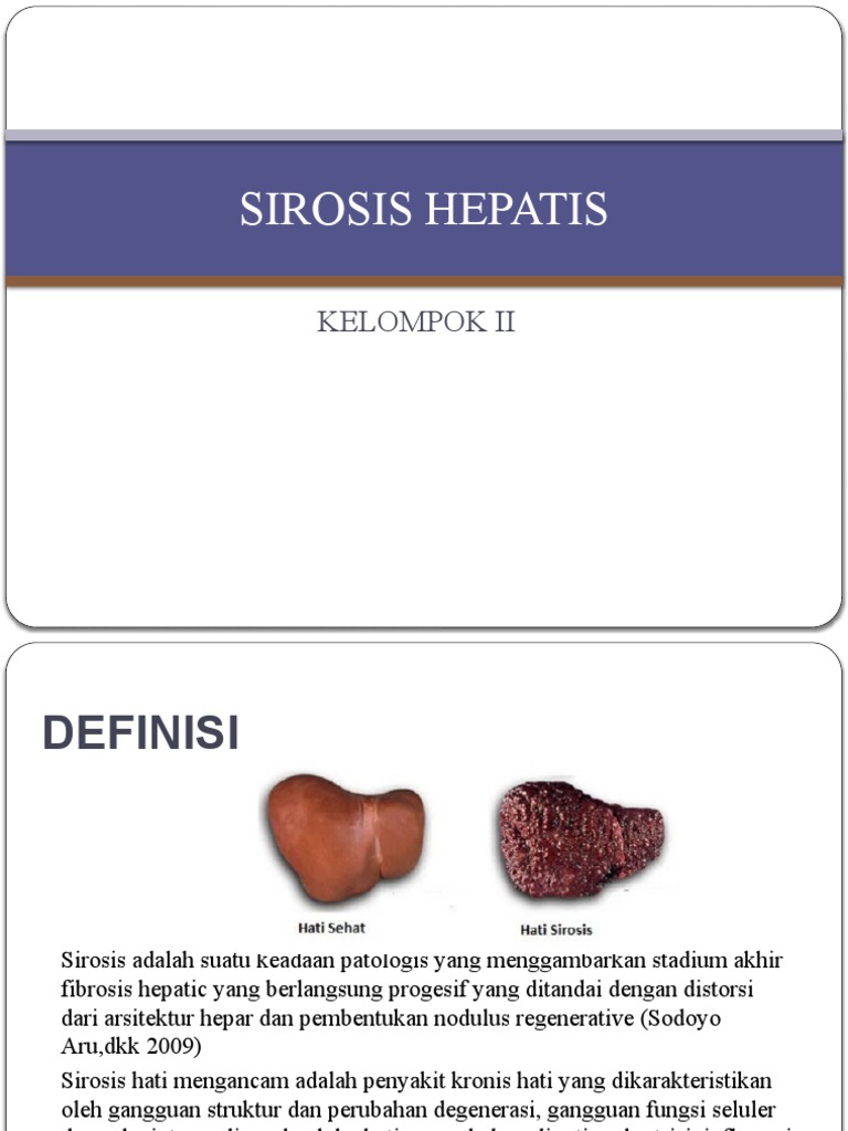 Sirosis Hepatis Vixx | PDF