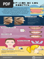 Protocolo Impresión Definitiva para Protesis Total | PDF | Dentadura ...