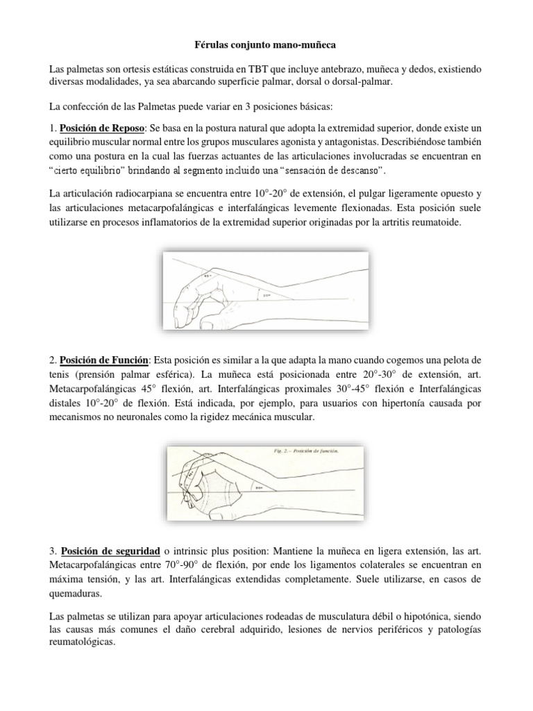 Férulas para mano y muñeca: Tipos y usos | PDF | Mano | Medicina