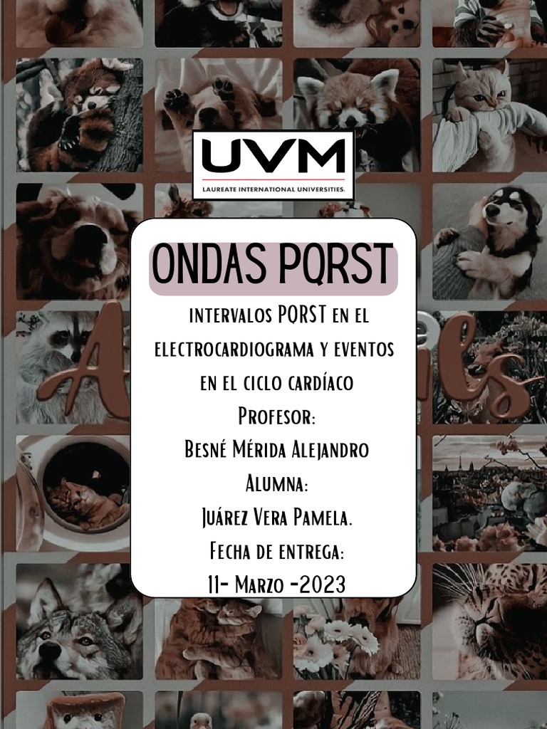 Ondas PQRST - PJV | PDF | Electrocardiografia | Sistema circulatorio