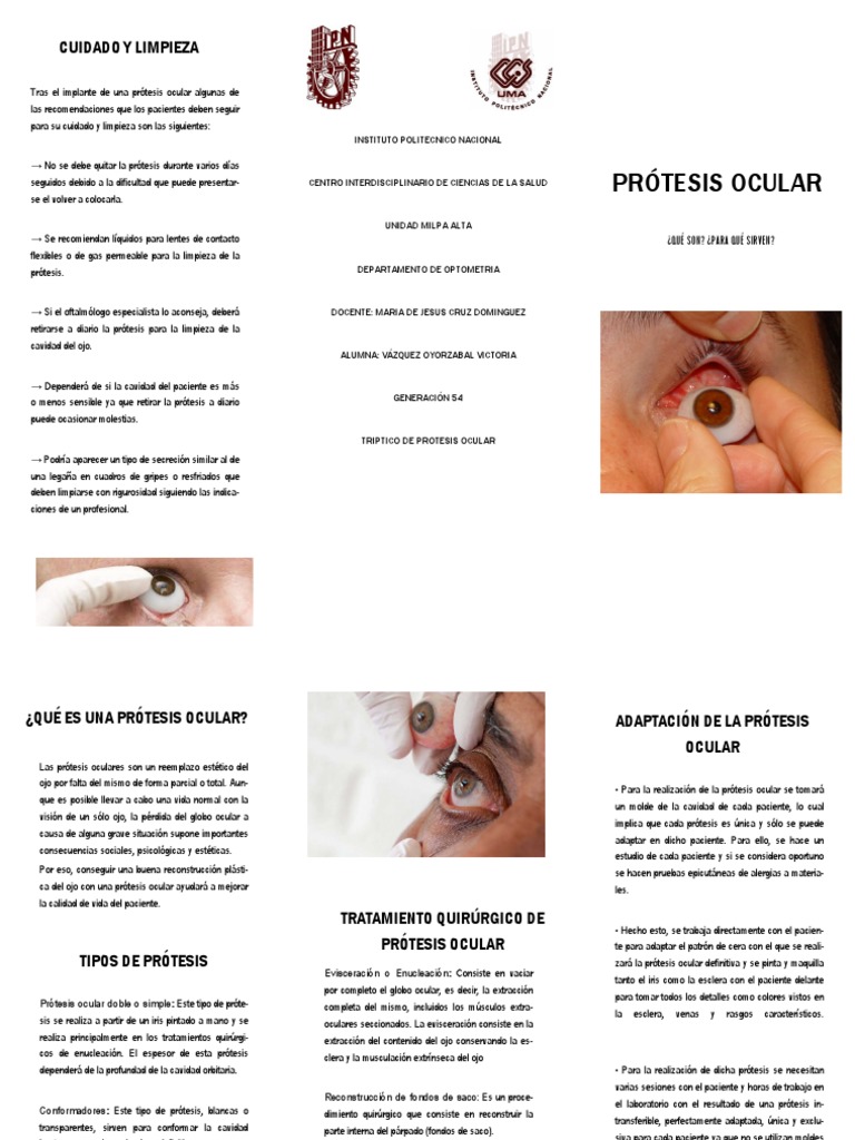 Guía sobre Prótesis Ocular y Cuidado | PDF | Ojo humano ...