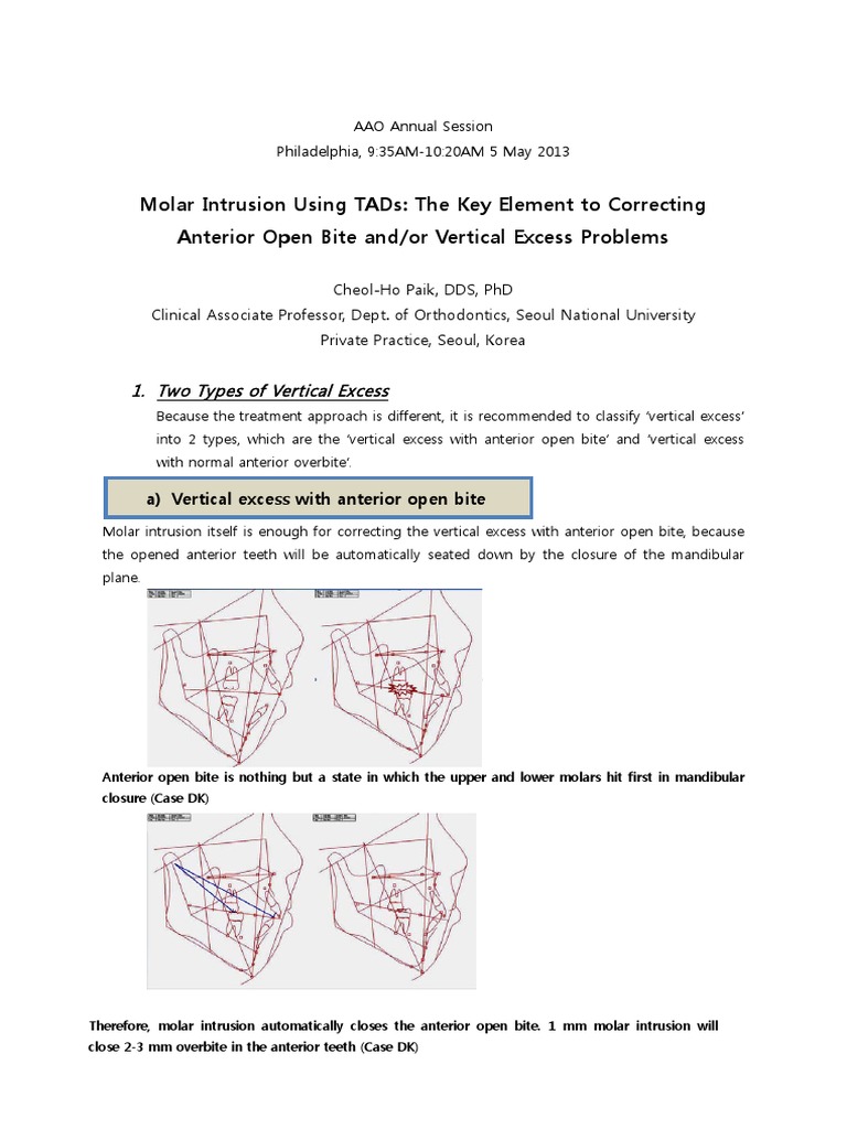 Molar Intrusion Using TADs | PDF | Dentistry Branches | Dental Anatomy
