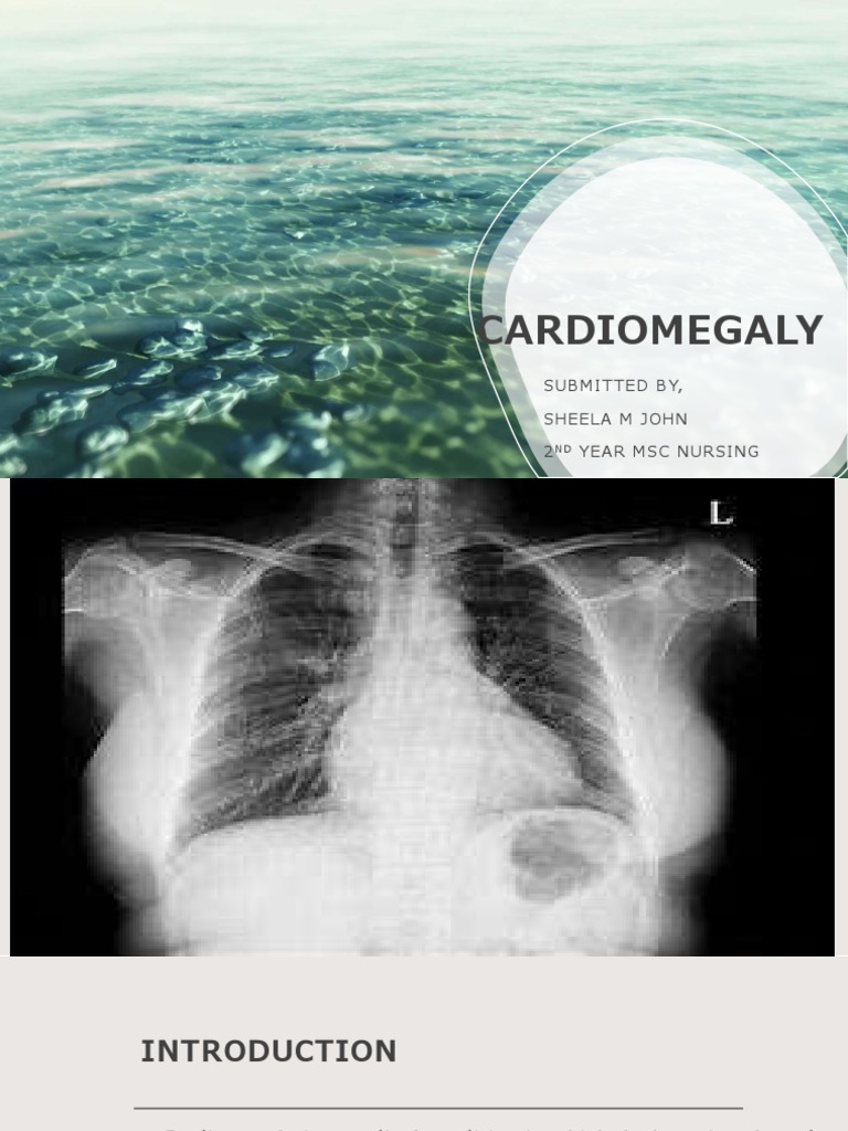 Cardiomegaly: Submitted By, Sheela M John 2 Year MSC Nursing | PDF ...