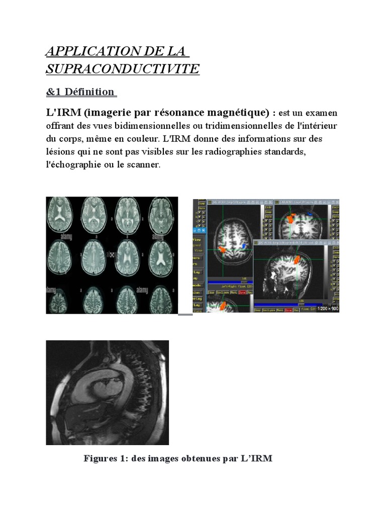 Application de La Supra-Conductivite IRM 2 | PDF | Imagerie par résonance magnétique ...