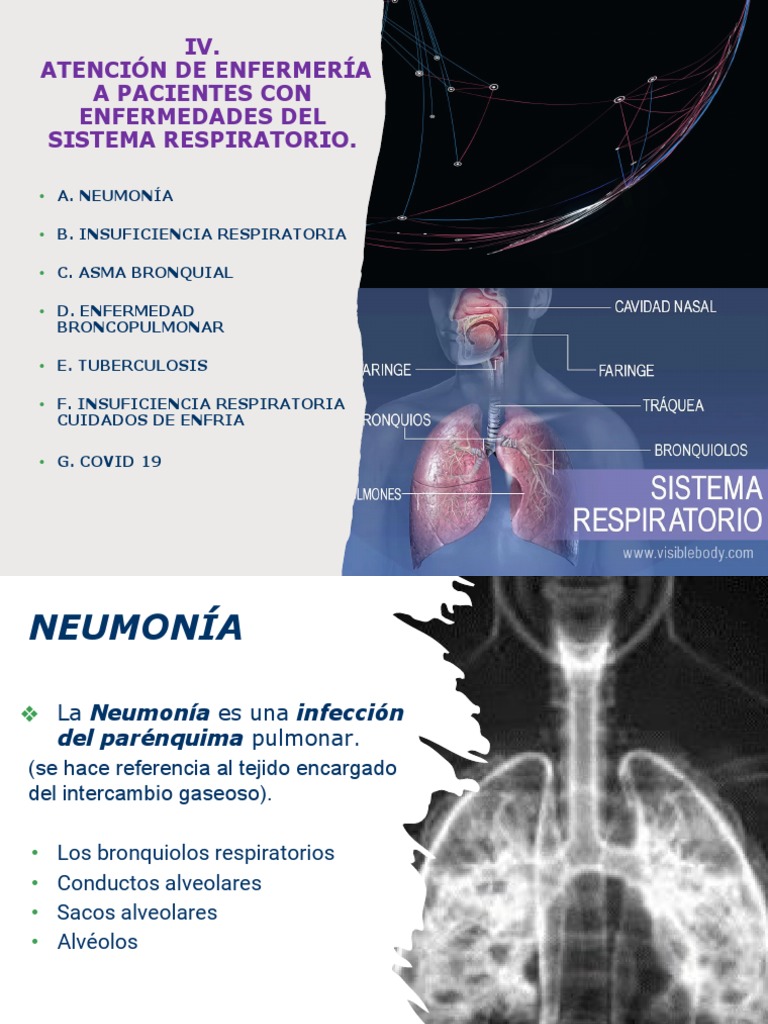 Neumonia | PDF | Neumonía | Pulmón