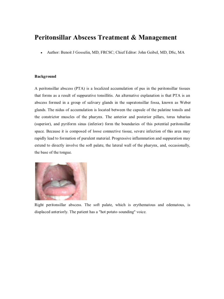 Peritonsillar Abscess | Lymphatic System | Anesthesia