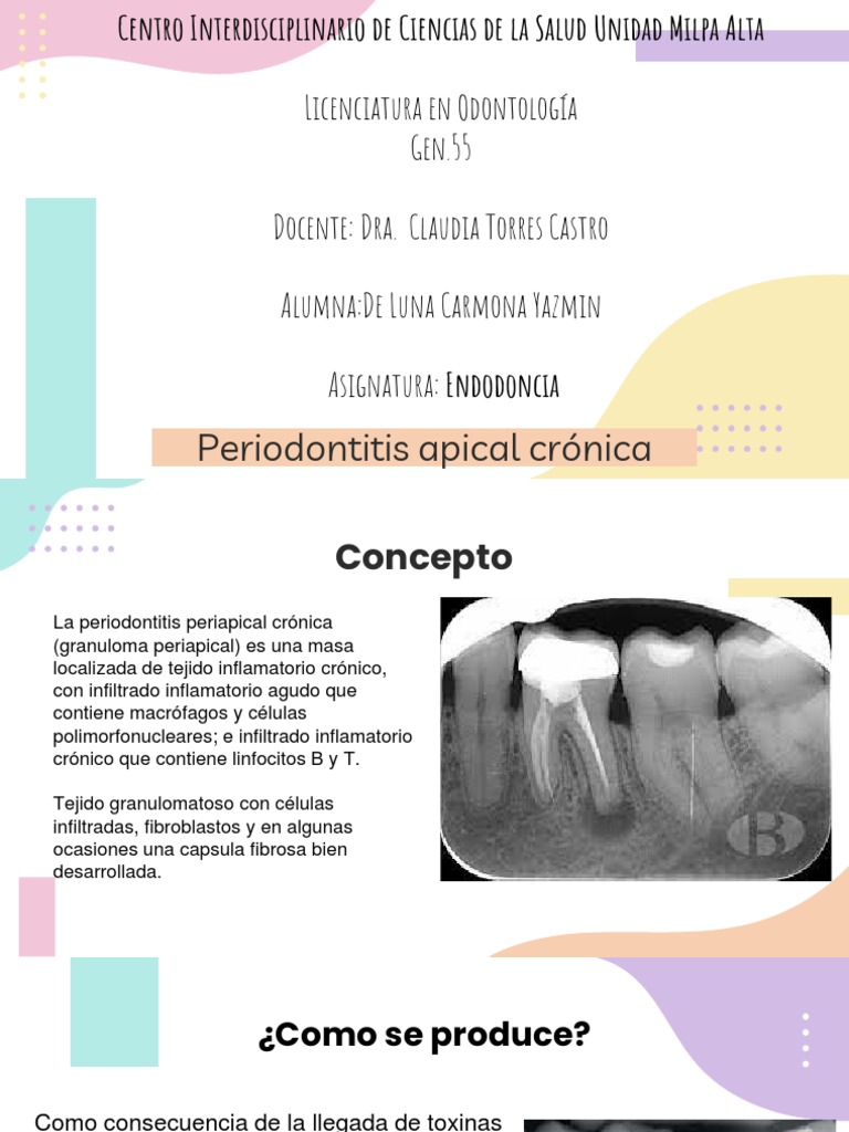 Periodontitis Apical Crónica | PDF | Inflamación | Epidemiología