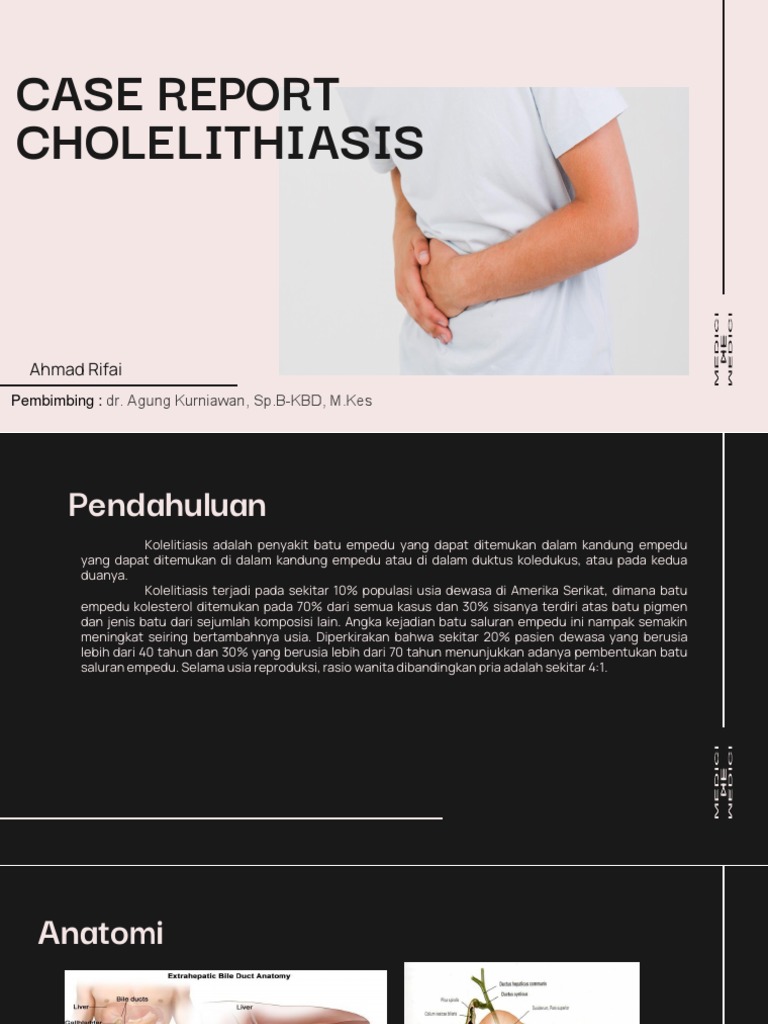 PPT REFKA CHOLELITIASIS | PDF