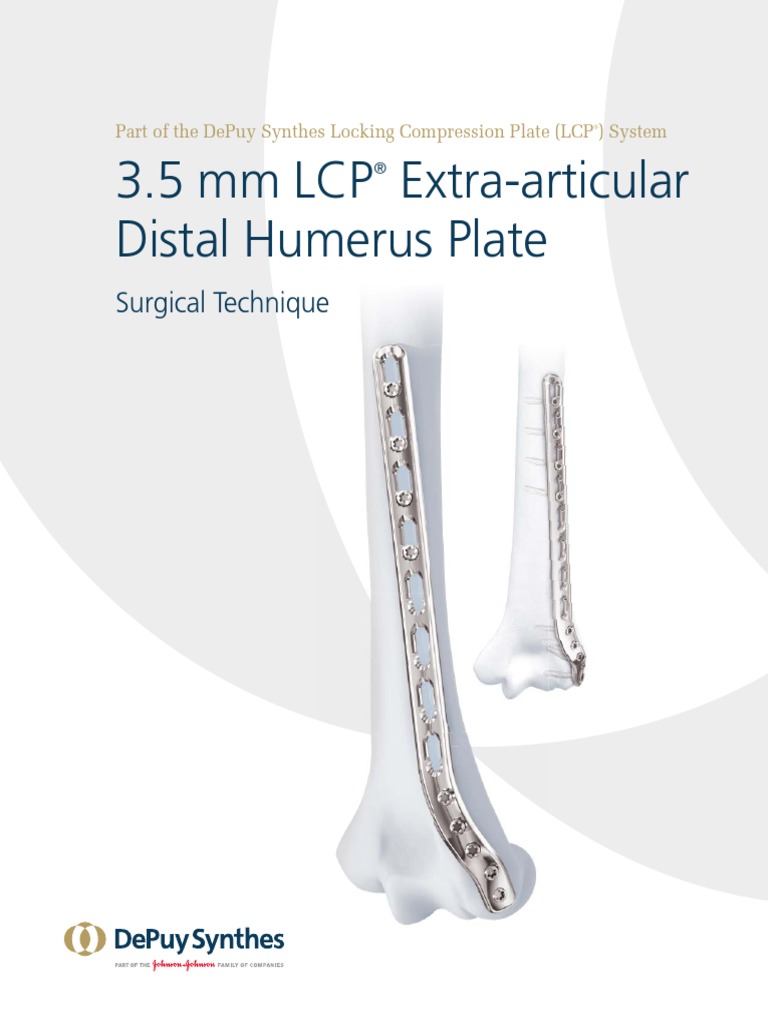 3.5 MM LCP Extra-Articular Distal Humerus Plate: Surgical Technique ...