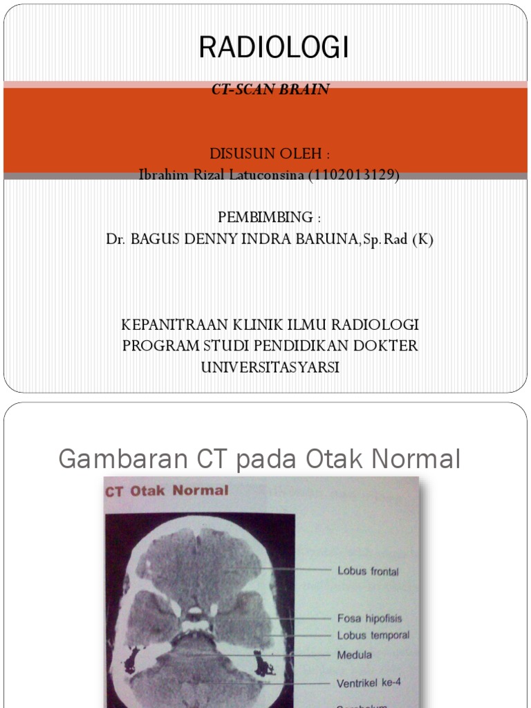 Radiologi CT Scan Brain Baim Fix | PDF | Perjalanan