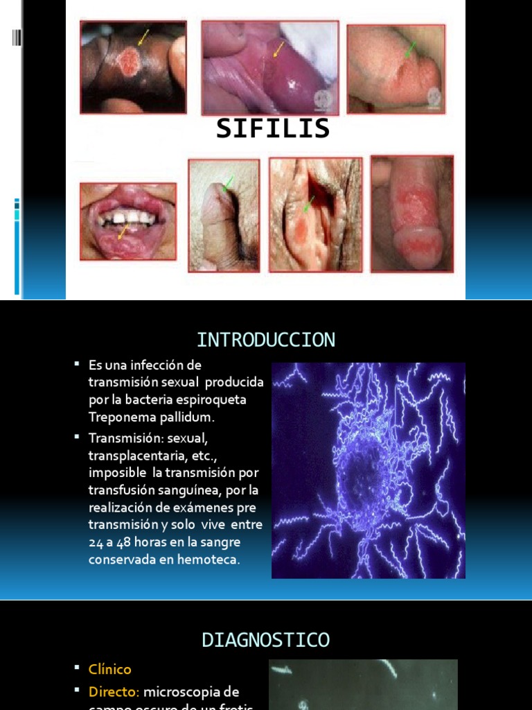 Diagnóstico de sífilis por Treponema pallidum | PDF | Medicina ...