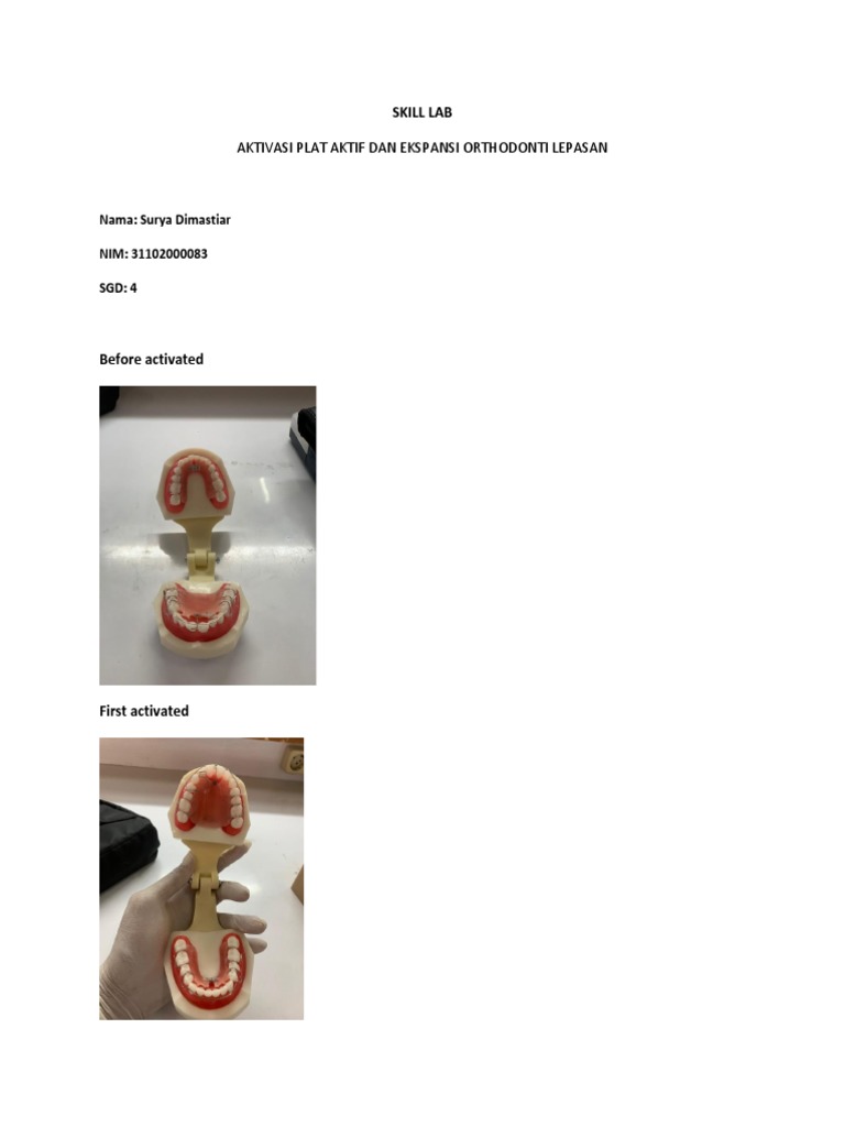 SGD4_SURYA DIMASTIAR_31102000083 | PDF