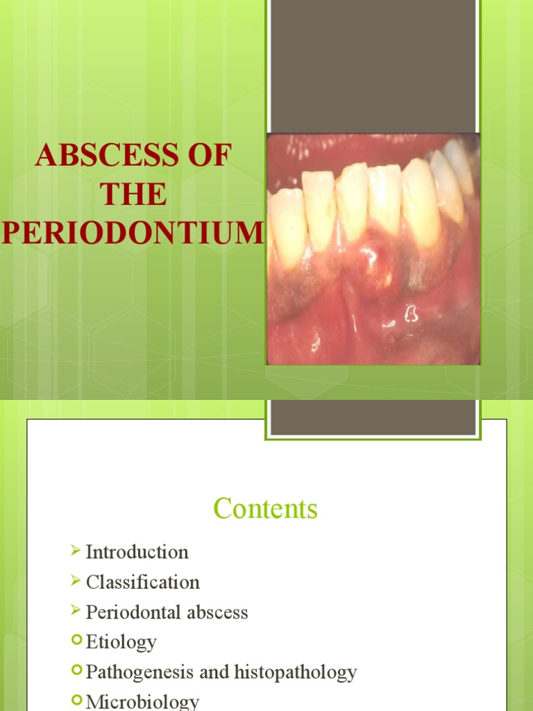 Abscess of THE Periodontium | PDF | Periodontology | Clinical Medicine