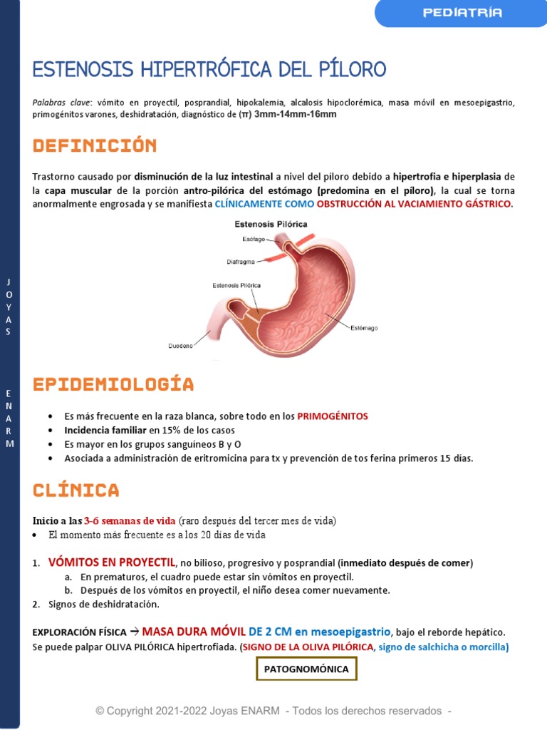 Estenosis Hipertrófica Del Píloro | PDF | Vómitos | Estómago
