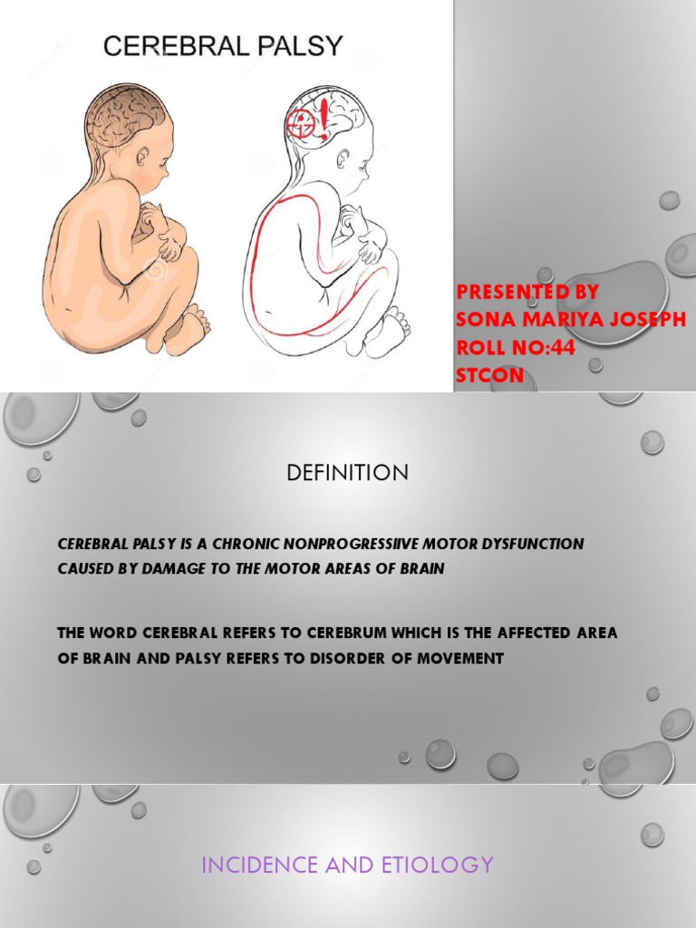 Athetoid Cerebral Palsy Overview | PDF | Cerebral Palsy | Medical ...