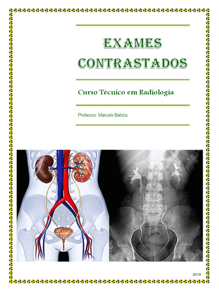 Guia Basico Exames Contrastados | PDF | Angiografia | Raio X