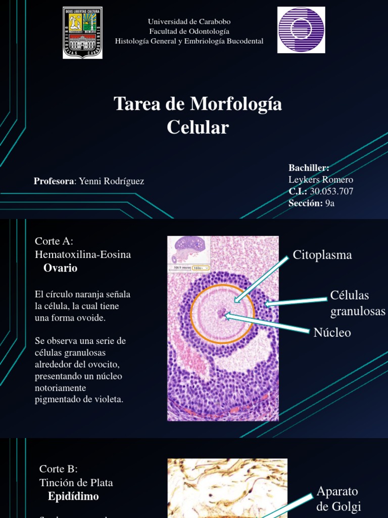 Tarea de Morfología Celular: Bachiller: C.I.: 30.053.707 Sección: 9a Profesora: Yenni Rodríguez ...