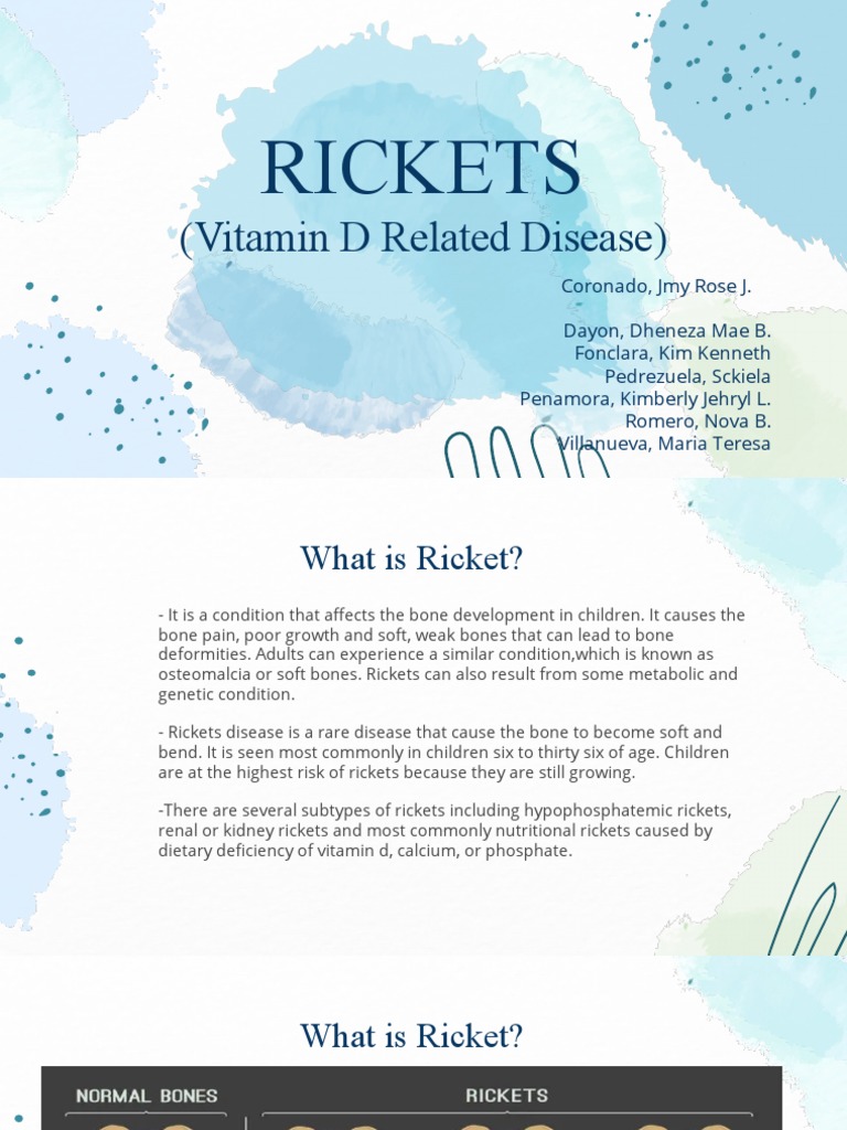 Nutritional Rickets: An In-Depth Look at Causes, Symptoms, Treatment ...