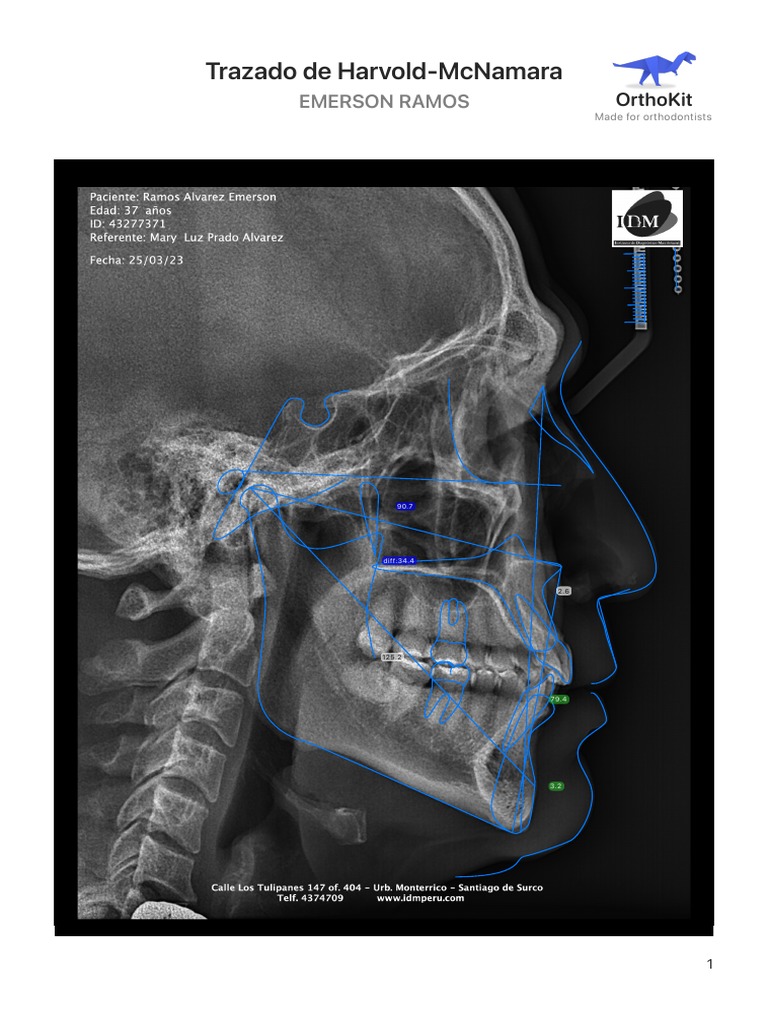 Trazado de Harvold-Mcnamara: Emerson Ramos | PDF | Anatomia dental ...