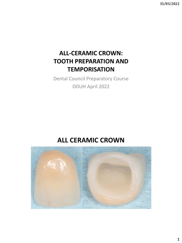 All-Ceramic Crown Preparation 2022 | PDF | Polymerization | Poly(Methyl ...