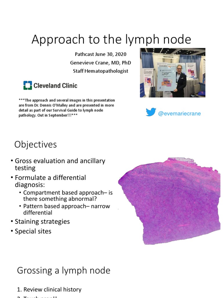 Genevieve Crane - Approach To Lymph Node-Path Cast Lymph Node Pathology ...