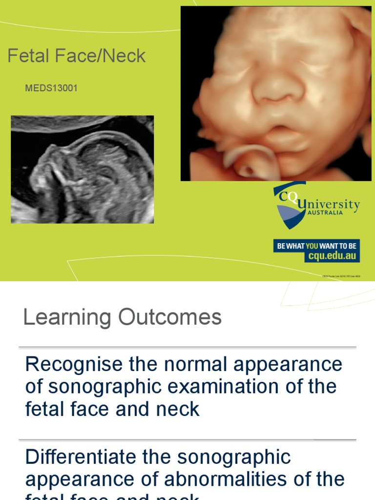 Fetal Face and Neck - Student Slides | PDF | Clinical Medicine ...