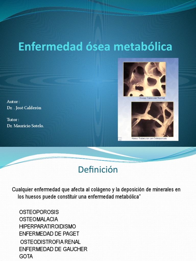 Enfermedad Ósea Metabólica Calderon | PDF | Hueso | Osteoporosis