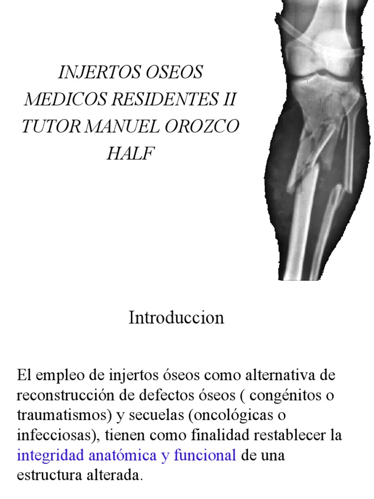 INJERTOS OSEOS | PDF | Hueso | Sistema musculoesquelético