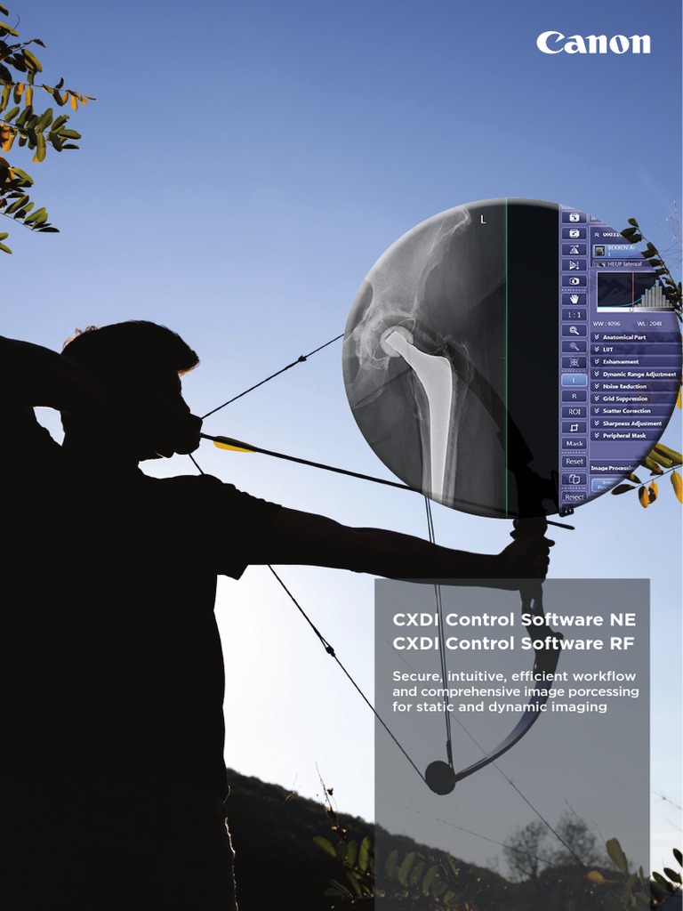 Canon CXDI Control Software Overview | PDF | Radiography | Medical Imaging