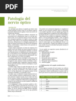 Anatomía y Patología de La Papila Óptica | PDF | Retina | Ojo humano