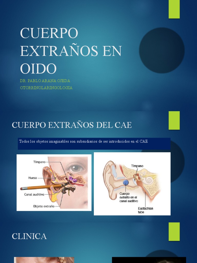 Cuerpos Extraños Oido Pdf