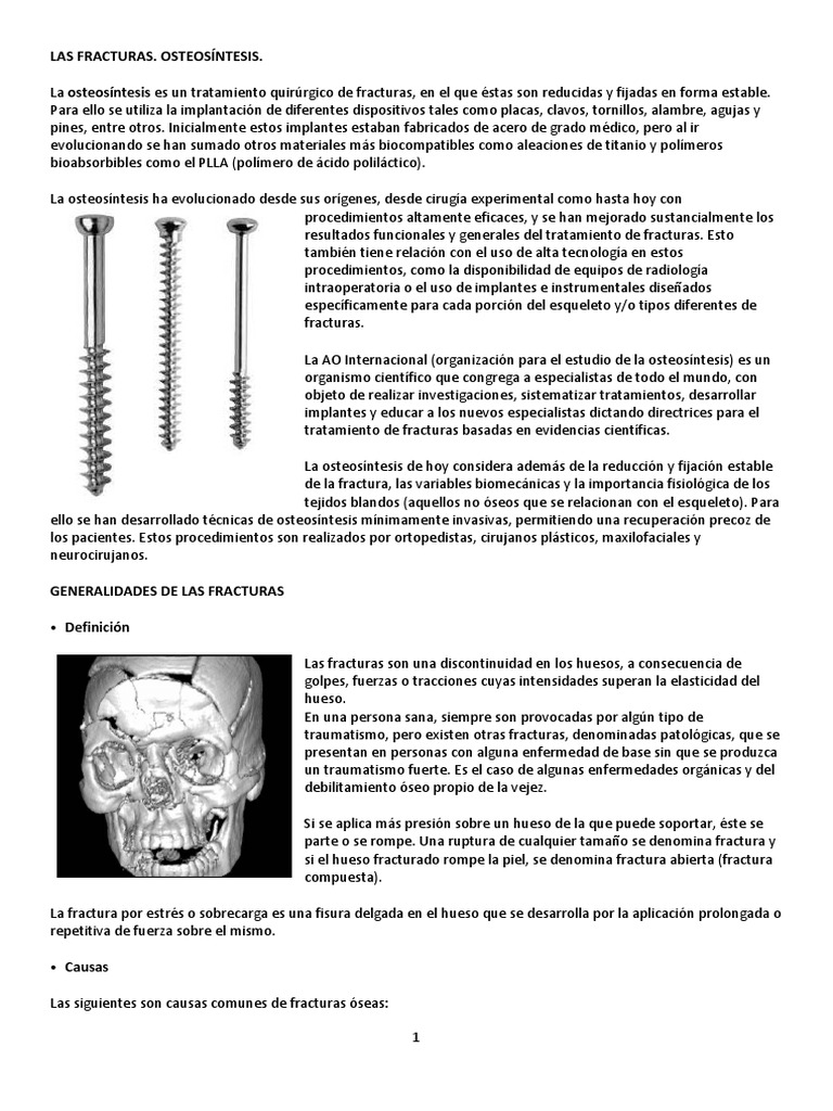 Definición y tipos de osteosíntesis | PDF | Medicina CLINICA | Sistema ...