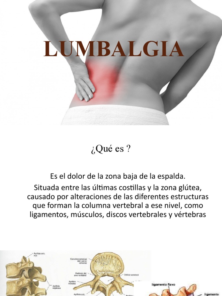 LUMBALGIA | PDF