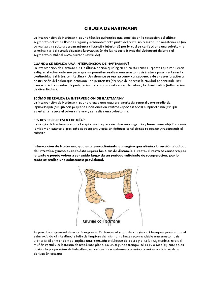 Cirugia de Hartmann | PDF | Cáncer colonrectal | Cirugía