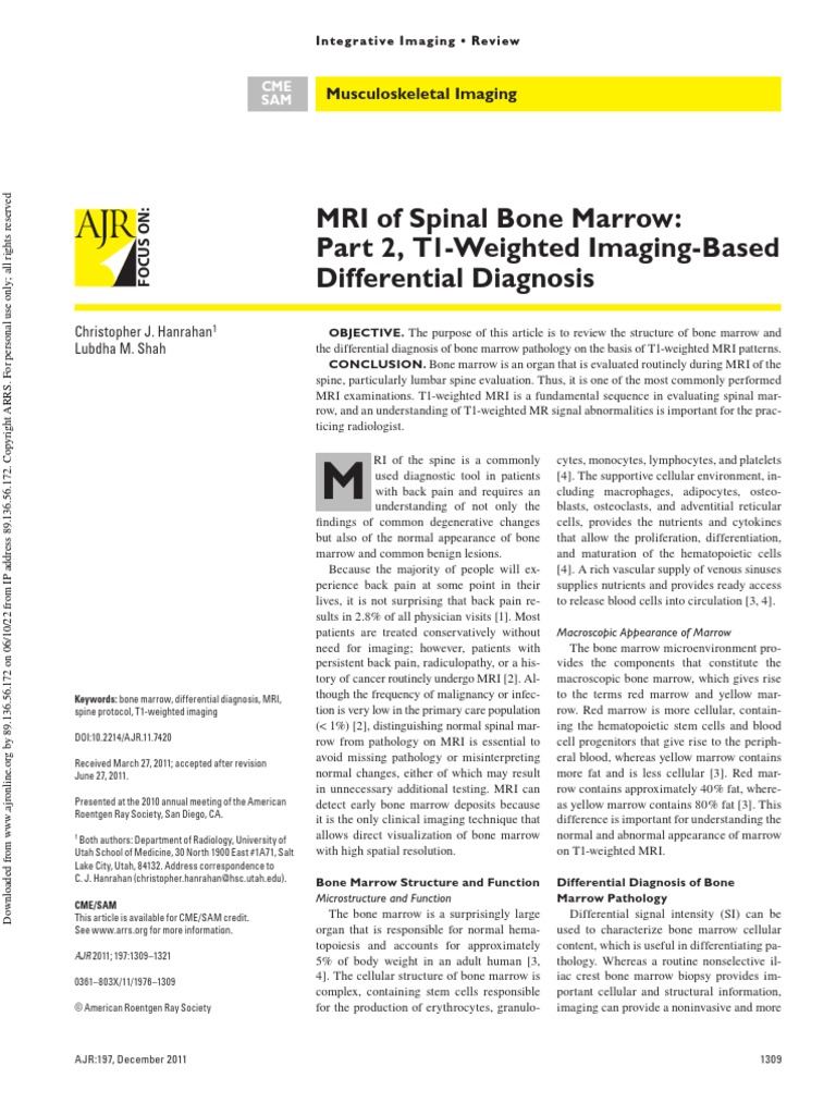 Bone Marrow T1-W Differential | PDF | Bone Marrow | Magnetic Resonance Imaging