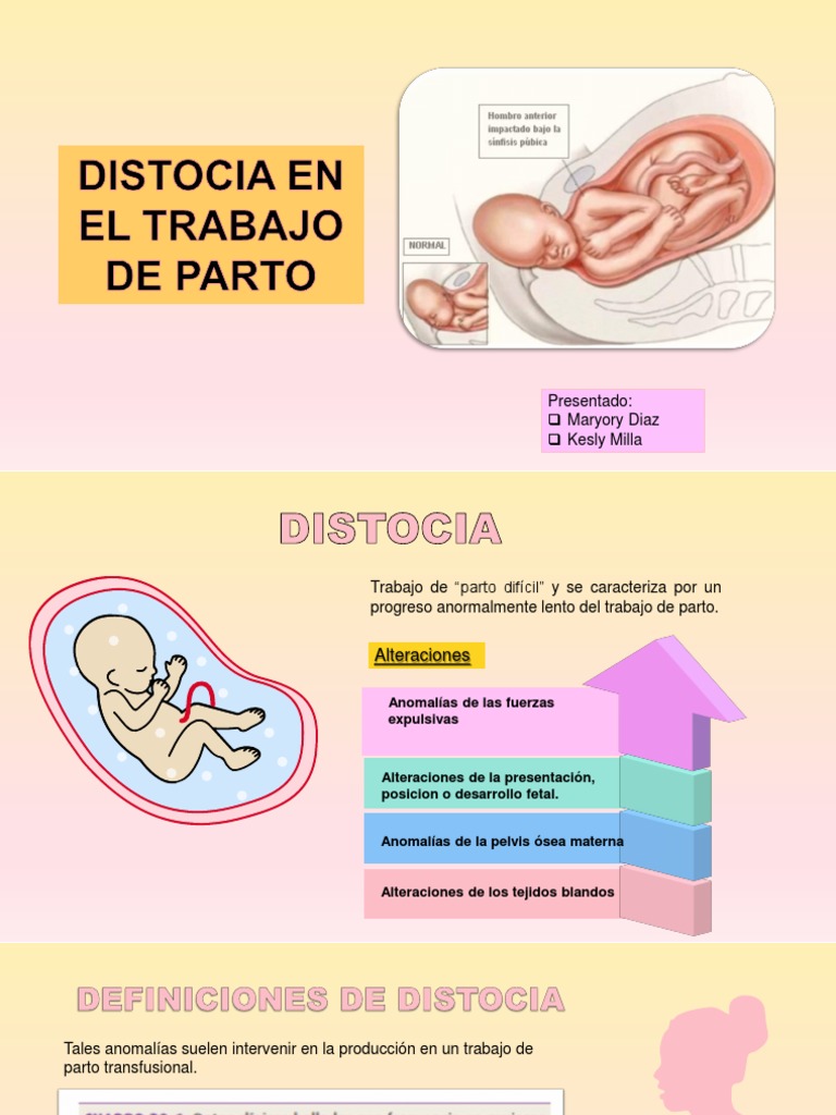 Distocia Del Trabajo de Parto GINECO II | PDF | Parto | Pelvis