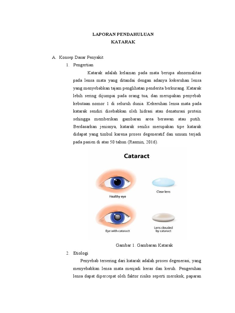 LP Katarak Done Bismillah | PDF