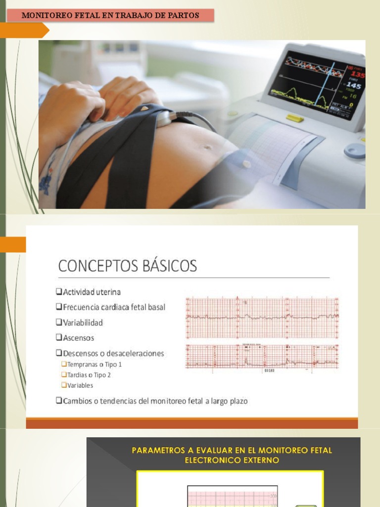 Monitoreo Fetal | PDF | Ciencia y matemáticas