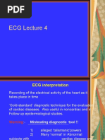 Right Ventricular Hypertrophy (RVH) - LITFL - ECG Library Diagnosis ...