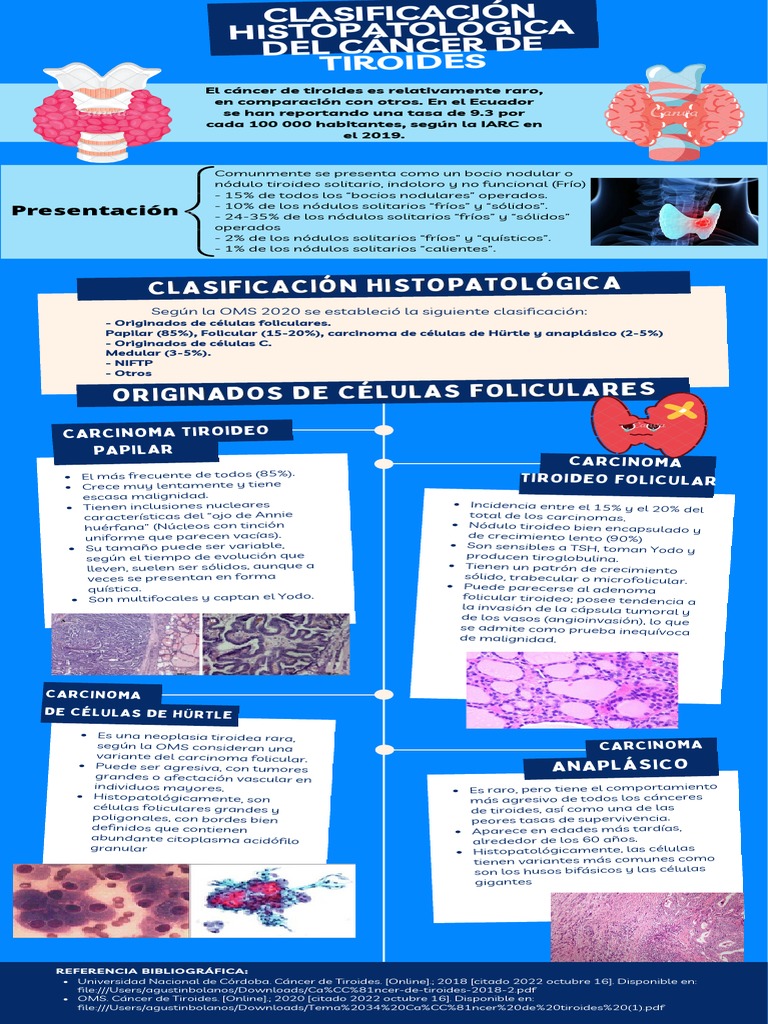 Clasificación Histopatológica Del Cáncer de Tiroides | PDF | Glándulas ...