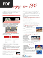 Tipos de Grampos | PDF