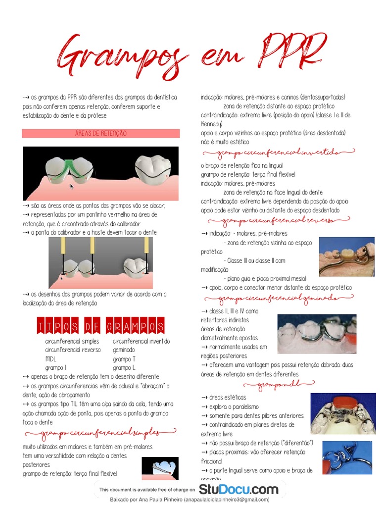 Grampos em PPR - Resumo | PDF | Dente