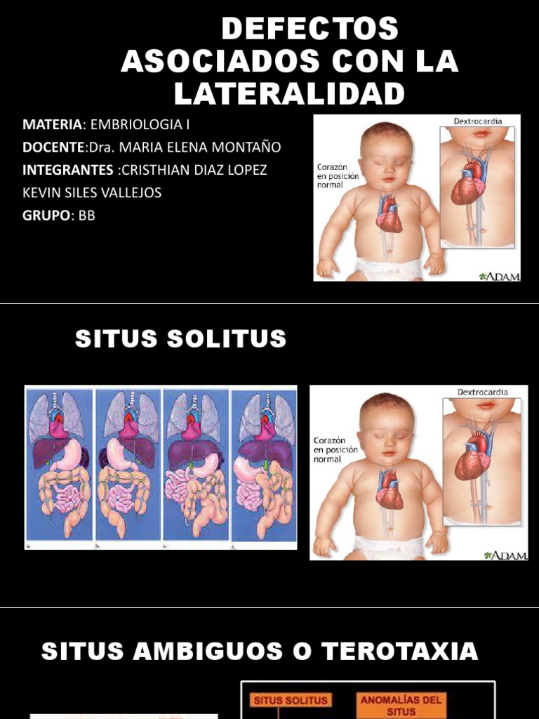 Defectos Asociado Con La Lateralidad | PDF