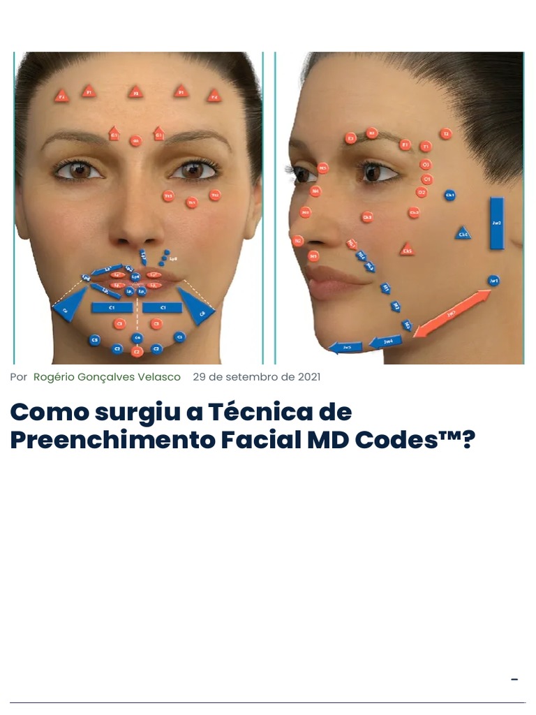 Como Surgiu A Técnica de Preenchimento Facial MD Codes™ | PDF ...