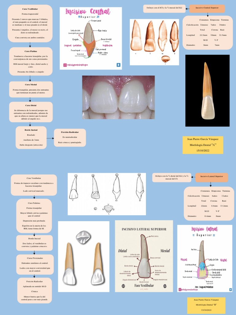 Descripción detallada de la morfología dental del incisivo central ...