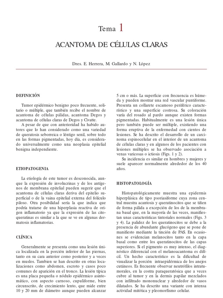 Acantoma de Celulas Claras | PDF | Epidermis | Epitelio