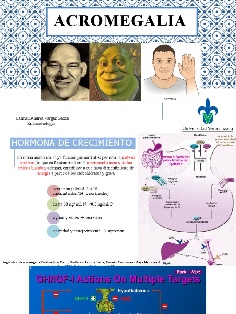 Acromegalia: Carmen Andrea Vargas Gazca Endocrinología | PDF | Hormona ...