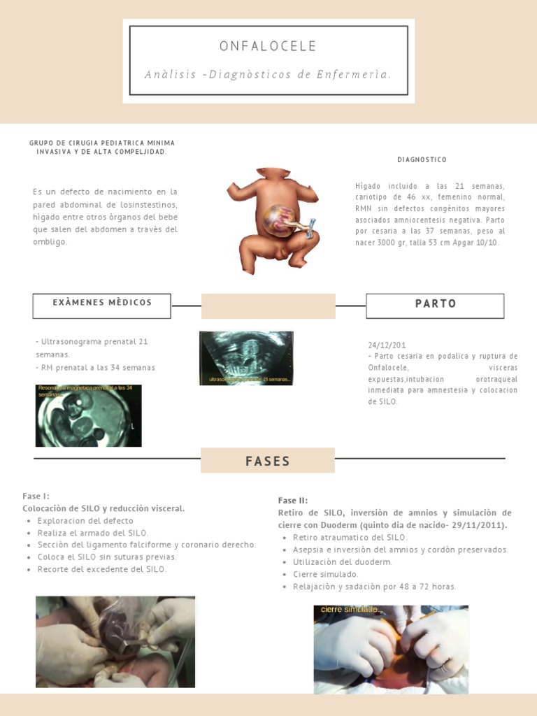 Onfalocele: Anàlisis - Diagnòsticos de Enfermerìa | PDF | Abdomen | Parto